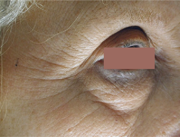 Dermaxyl® | Croda Beauty