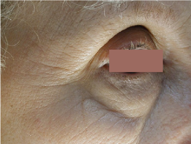 Dermaxyl® | Croda Beauty