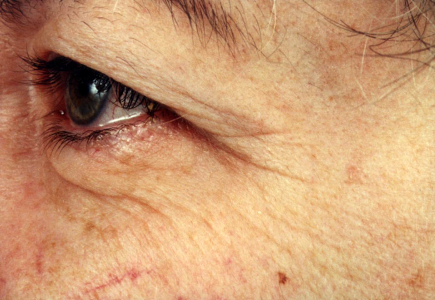 Matrixyl® | Croda Beauty