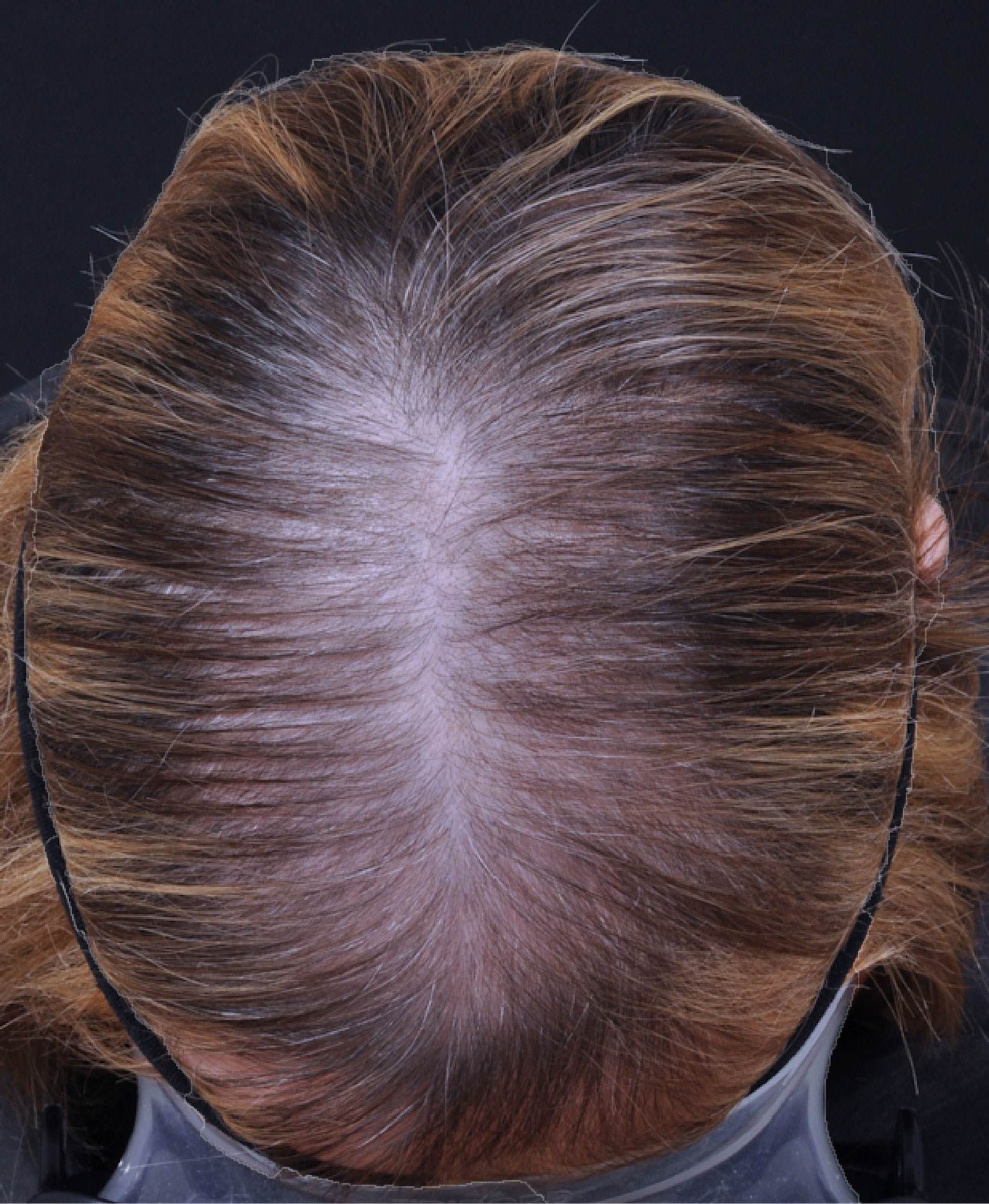 Procapil™ | Croda Beauty