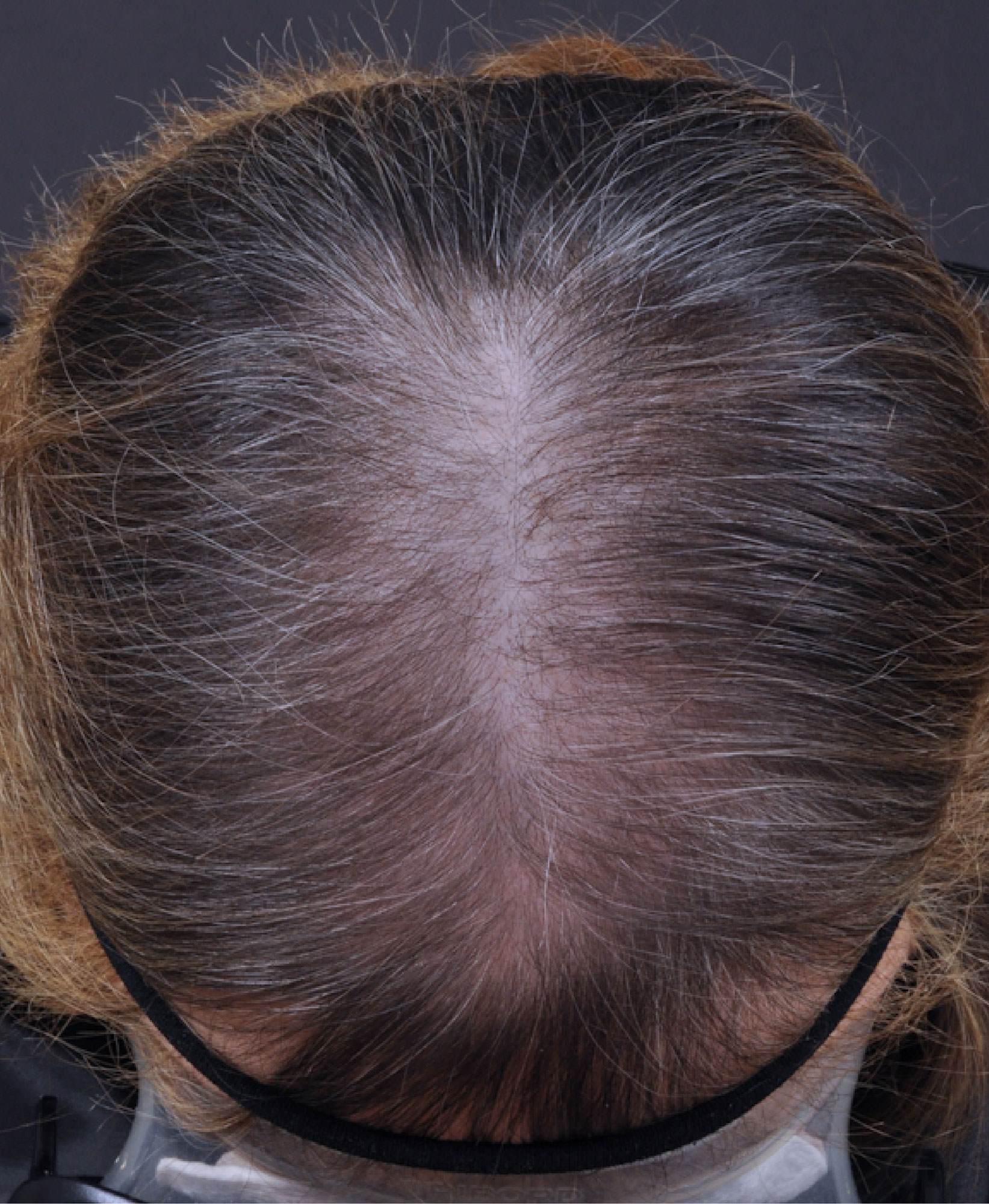 Procapil™ | Croda Beauty